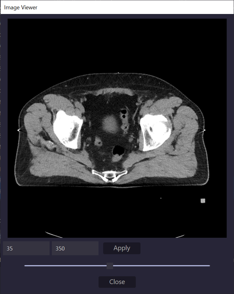 GitHub - agerecnik/dicom-editor