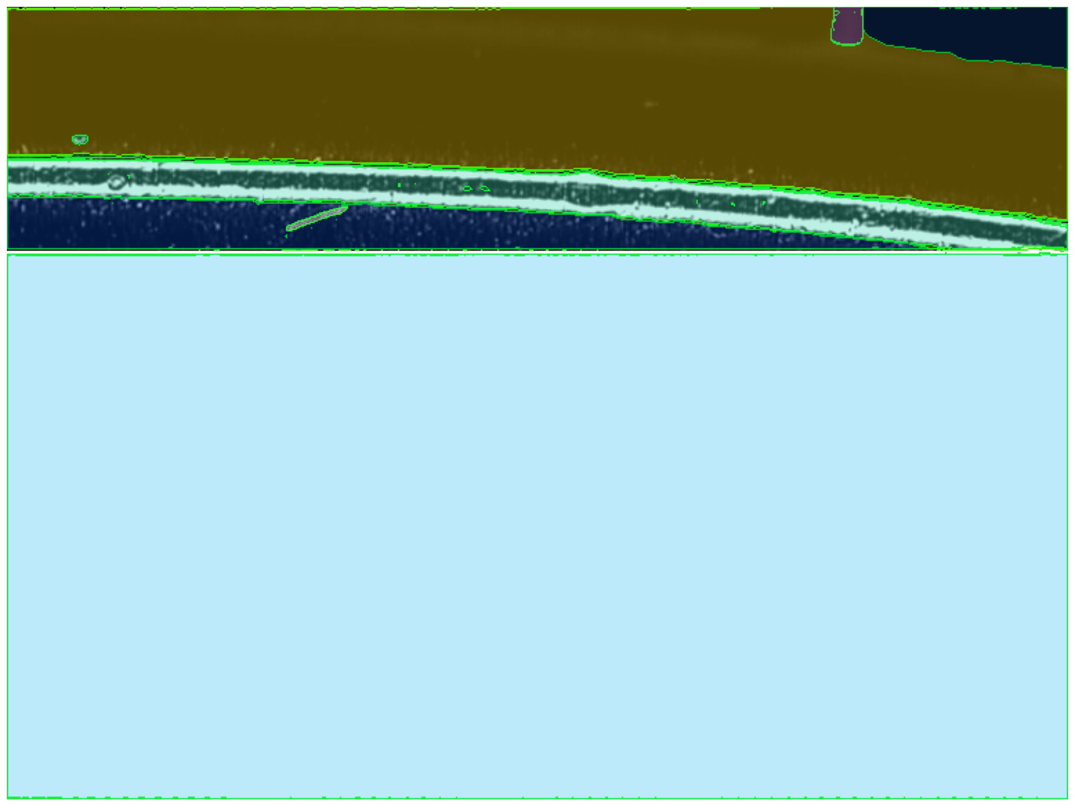 the segmentation result of automatic_mask_generator_example.ipynb is not as good as that on ...