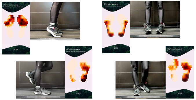 GitHub - KlaudiaKromolowska/Foot_plantar_pressure_monitoring_system: A ...