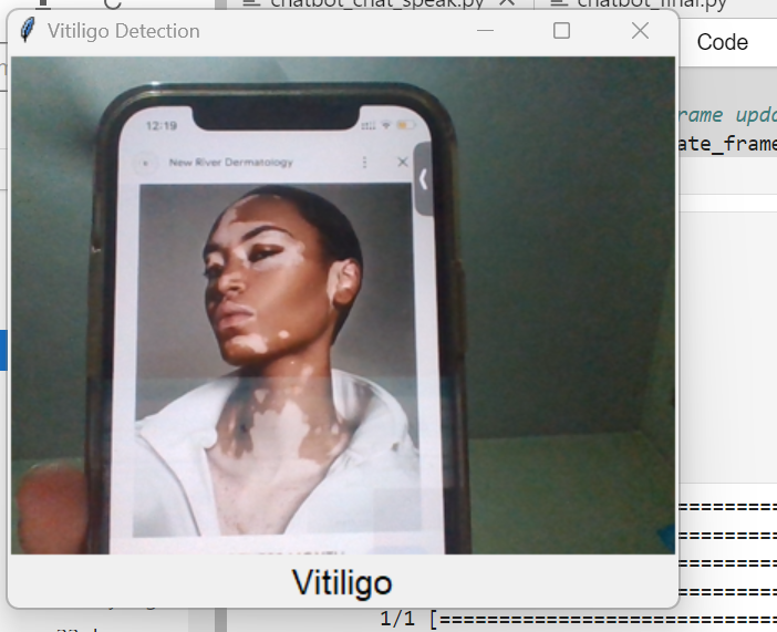 GitHub - Anupriyamalik/vitiligo-detection: Deep learning-based system for real-time ...