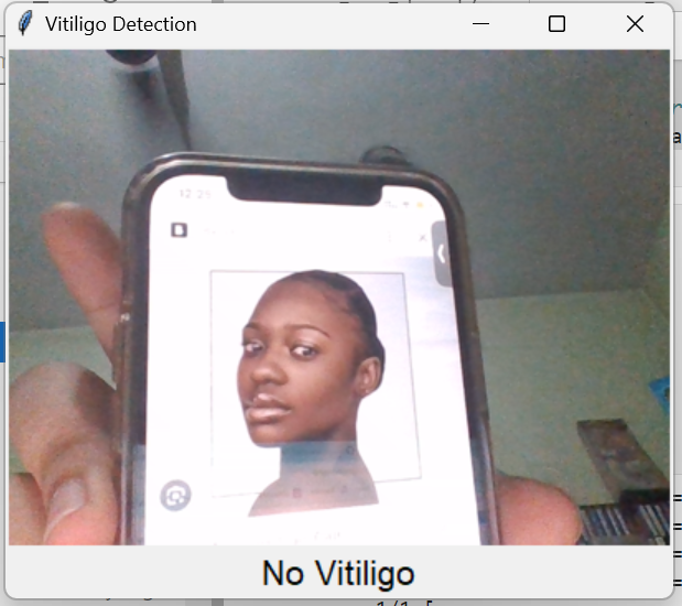 GitHub - Anupriyamalik/vitiligo-detection: Deep learning-based system ...