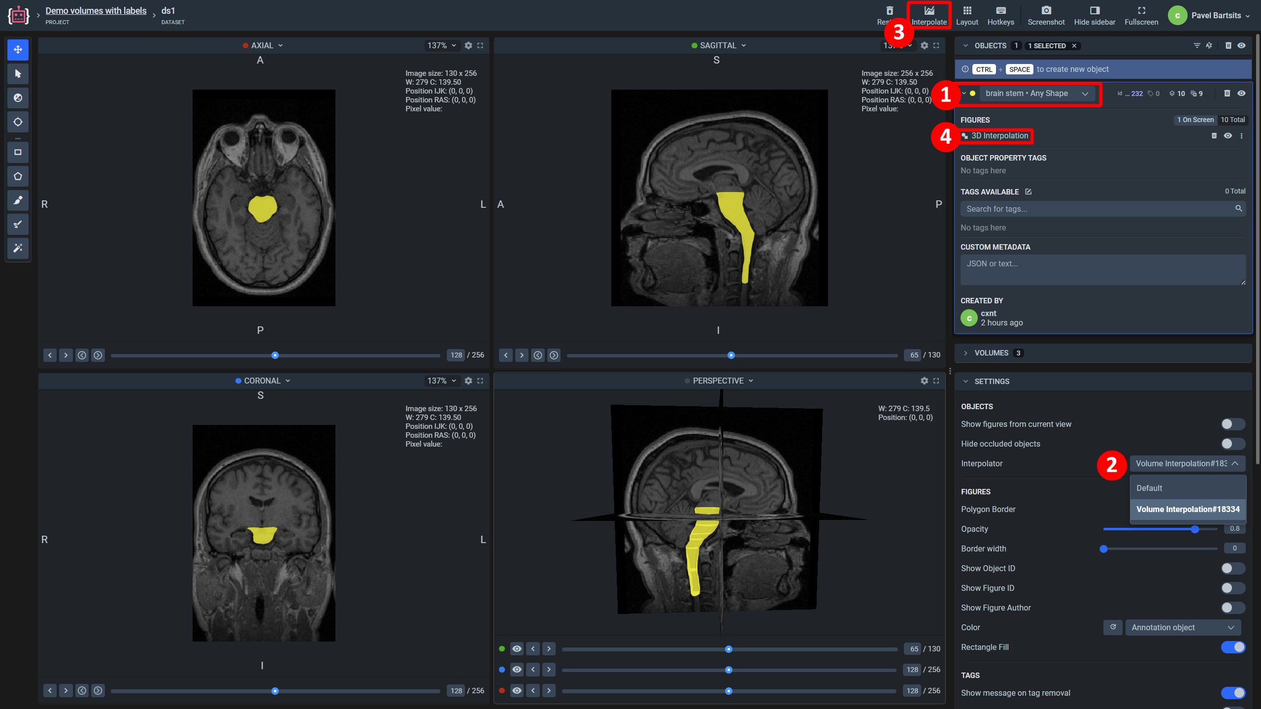 GitHub - supervisely-ecosystem/volume-interpolation