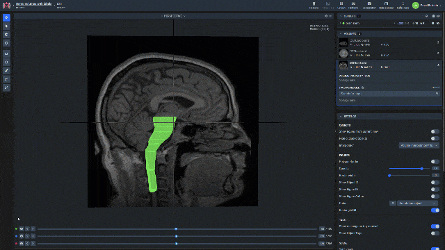 GitHub - supervisely-ecosystem/volume-interpolation