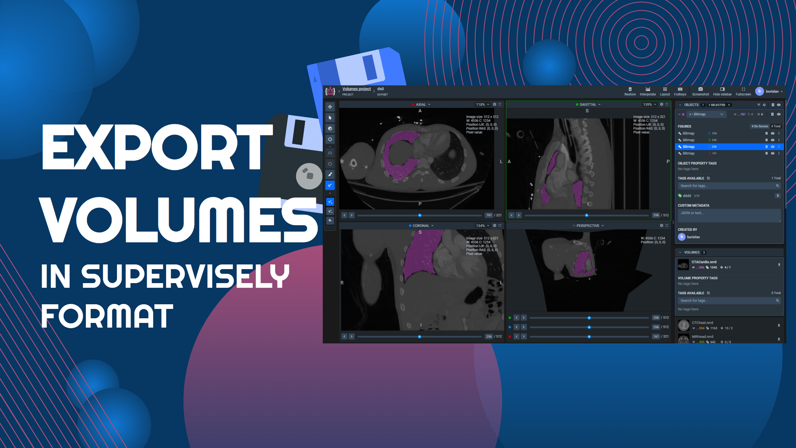 GitHub - supervisely-ecosystem/export-volume-project: Export Volume project in Supervisely Format