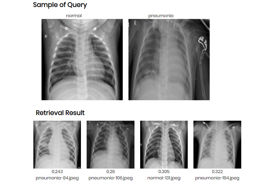 GitHub - tiaraintana/xray-cbir-project-heroku