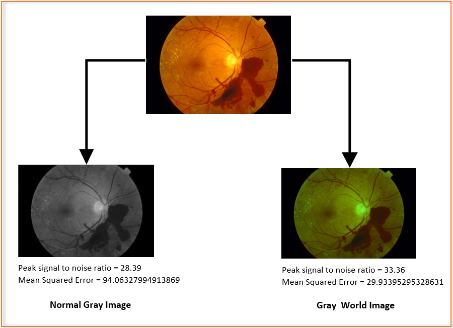 GitHub - pingo9o1/Diagnosis-of-Diabetic-Retinopathy-using-Stacked-CNN ...