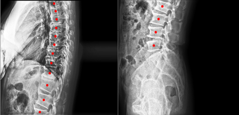 GitHub - limsungjoo/Vertebra_segmentation: Vertebra (lateral view) X ...