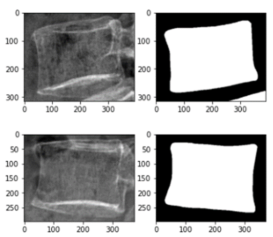 GitHub - limsungjoo/Vertebra_image_processing: Pre-processing and post-processing for Vertebra ...