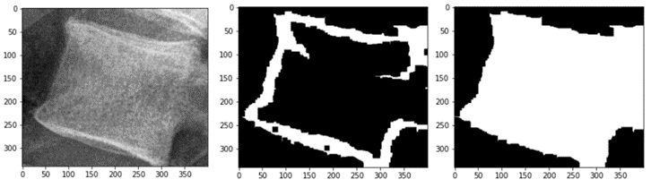 GitHub - limsungjoo/Vertebra_image_processing: Pre-processing and post-processing for Vertebra ...
