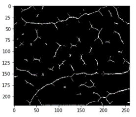 GitHub - limsungjoo/Vertebra_image_processing: Pre-processing and post-processing for Vertebra ...