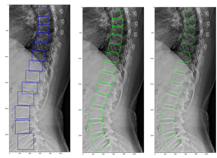 GitHub - limsungjoo/Vertebra_image_processing: Pre-processing and post-processing for Vertebra ...