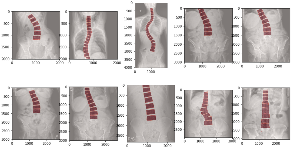 GitHub - limsungjoo/Deepnoid