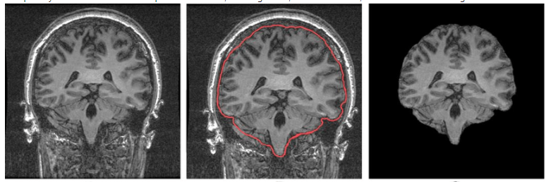 GitHub - Madniel/deep_learning_segmentation_in_skull_stripping: The ...