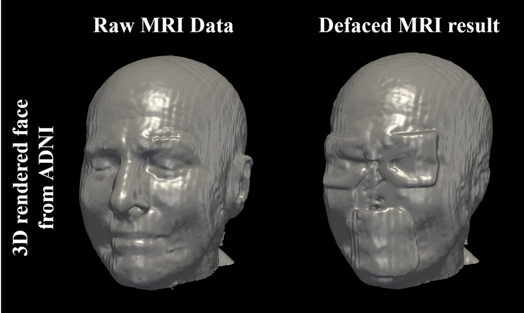 GitHub - yeonuk-Jeong/Defacer: Asan medical center medical image ...