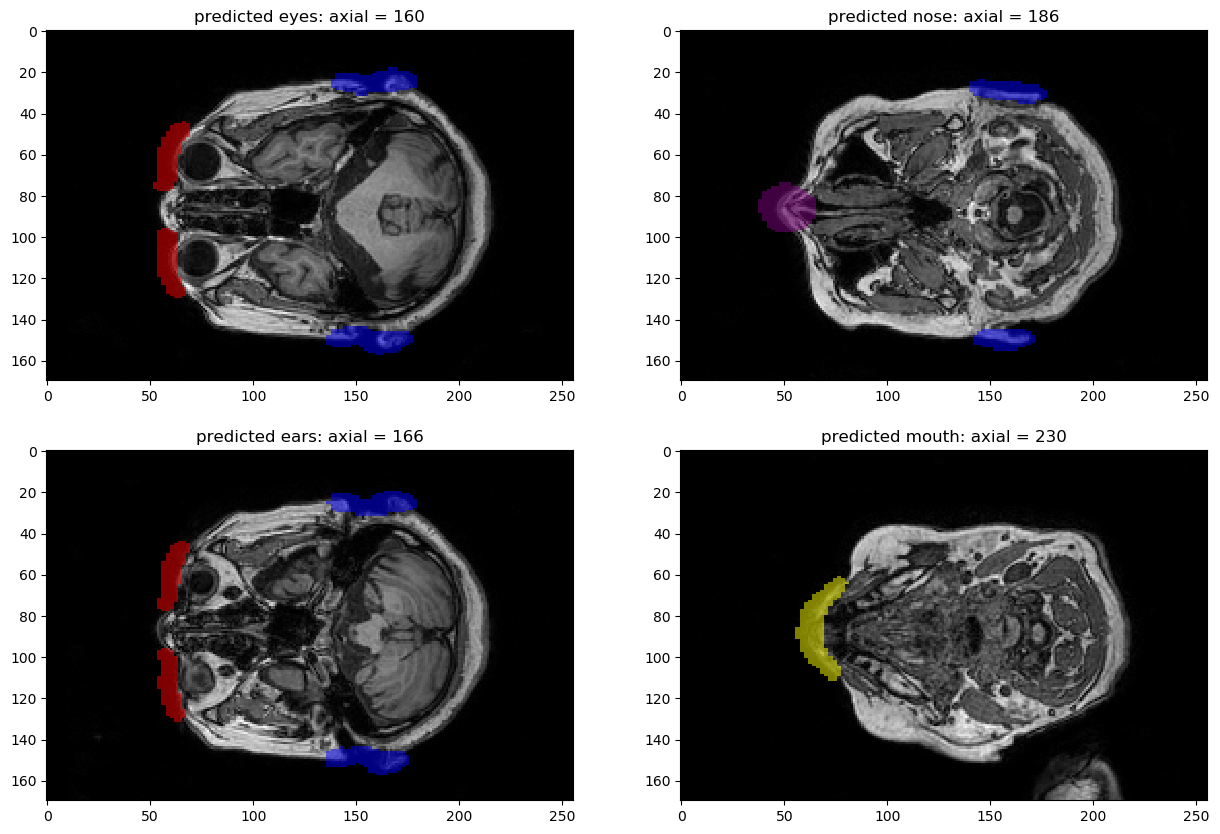 GitHub - yeonuk-Jeong/Defacer: Asan medical center medical image ...