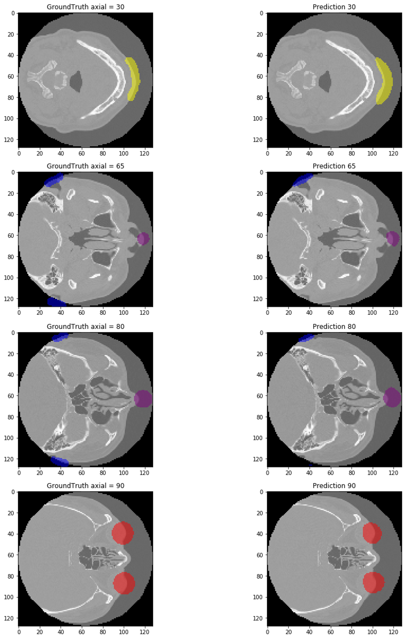 GitHub - yeonuk-Jeong/Defacer: Asan medical center medical image ...