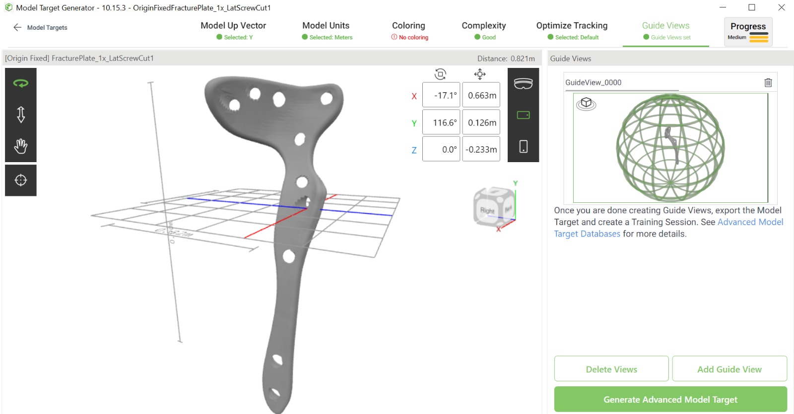 GitHub - sarpermelikertekin/3dv-project-advanced-surgical-planning-implant-recognition
