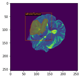 Using data augmentation results in large boxes than expected · Issue #4292 · facebookresearch ...