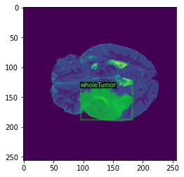 Using data augmentation results in large boxes than expected · Issue ...