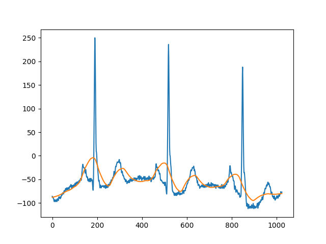 Can denoise_wavelet be used to 1D time series? · Issue #2974 · scikit ...