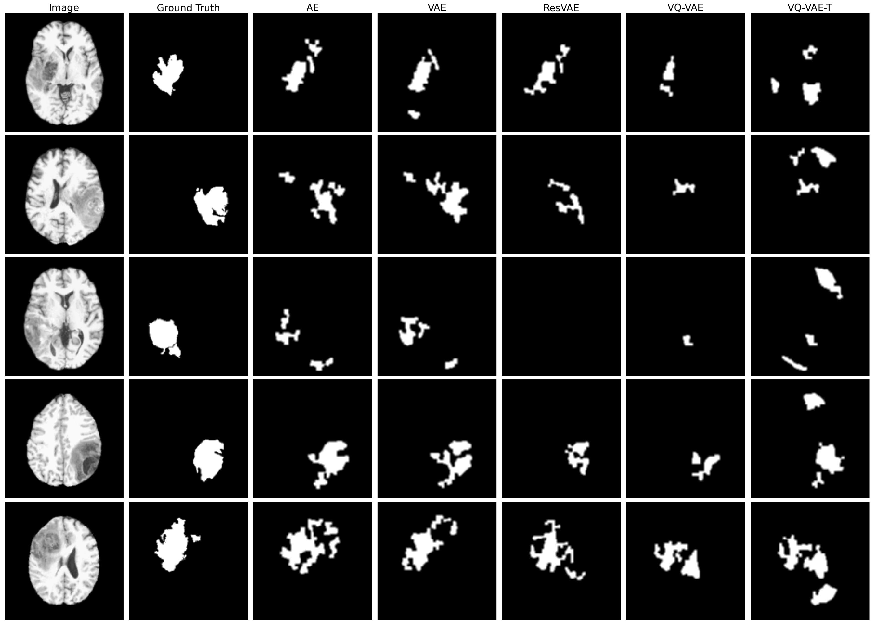 Github Iamkzntsv Self Supervised Learning Mri This Project Explores The Use Of Latent