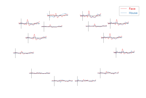 Allow adding electrode names next to evoked plots in evoked.plot_topomap · Issue #5746 · mne ...