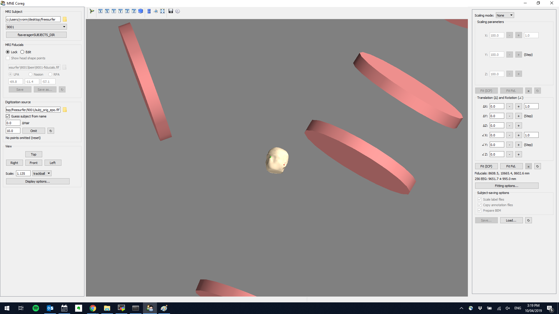 floating electrodes, misalignment between default montage and mri space ...