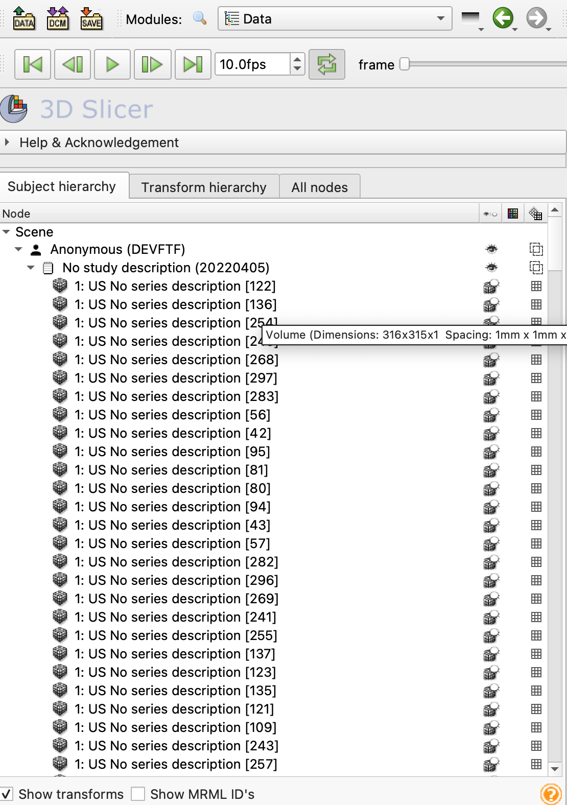 Loading a US DICOM volume gets loaded as a set of slices and not a ...
