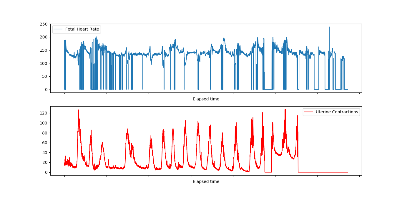 GitHub - hvauchar/LSTM-based-Fetal-Distress-Classification: This project presents the study to ...
