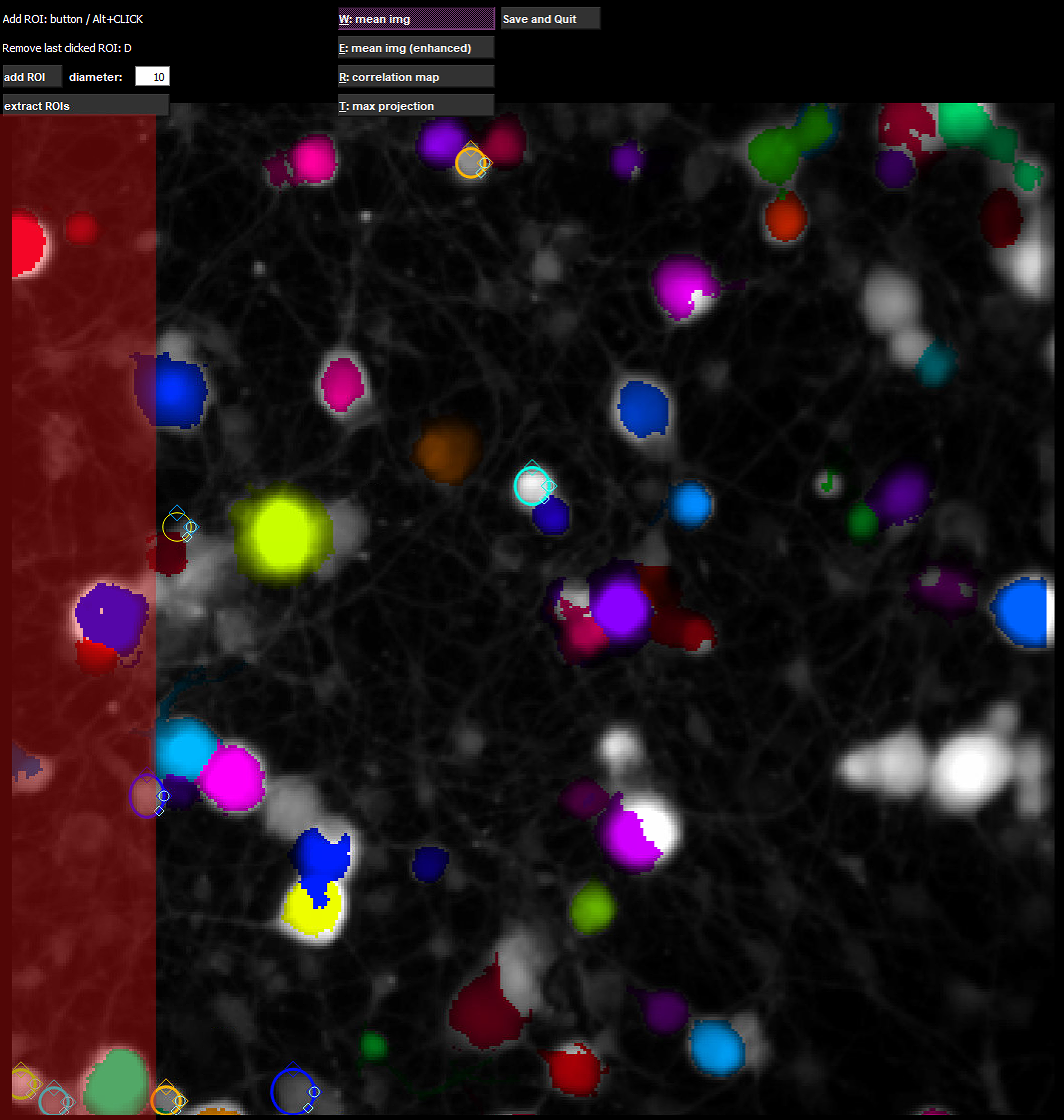 Unresponsive area in manual labelling GUI · Issue #306 · MouseLand/suite2p · GitHub