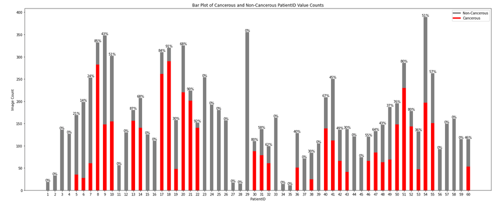GitHub - NishqR/Cancer-Cell-Detection: Deep Learning project that uses ...