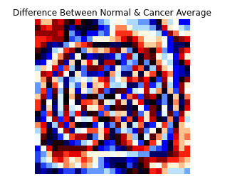 GitHub - NishqR/Cancer-Cell-Detection: Deep Learning project that uses ...