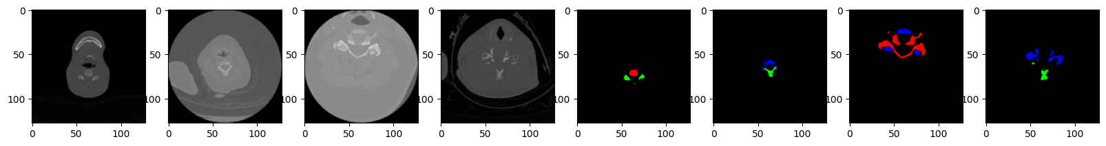 GitHub - bishnarender/rsna-2022-cervical-fracture-detection: Detection and localization of ...