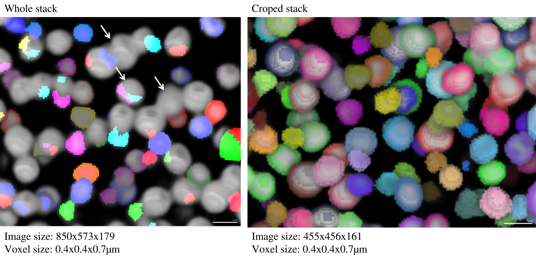 Erronous segmentation of the whole stack, But a cropped region works perfectly. · Issue #454 ...