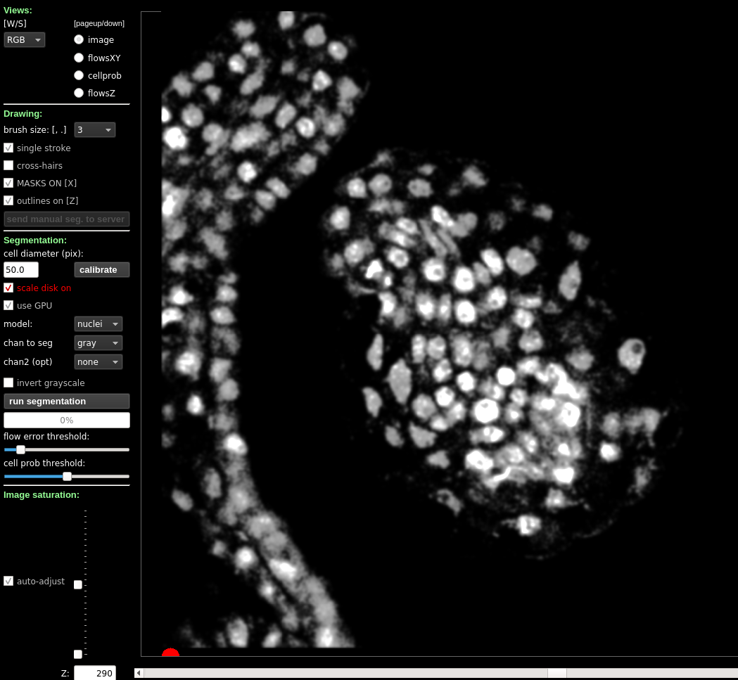 Does preprocessing the raw image help in better segmentation? · Issue #62 · MouseLand/cellpose ...