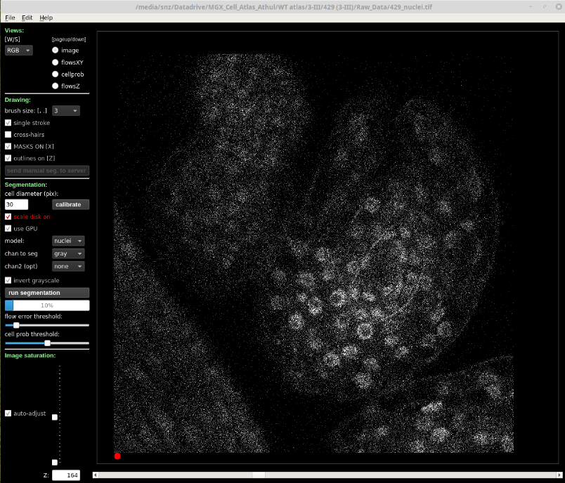Does preprocessing the raw image help in better segmentation? · Issue #62 · MouseLand/cellpose ...
