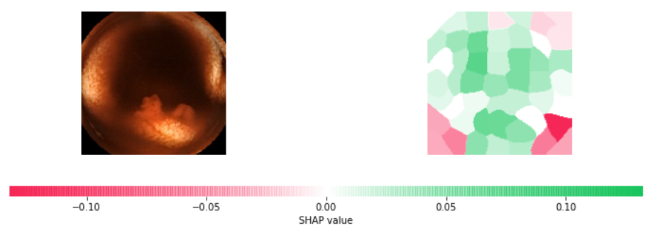 KernelShap class problem (binary) · Issue #1652 · shap/shap · GitHub