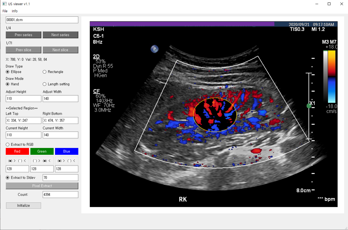 GitHub - djchoi1742/US_viewer: Software to measure Doppler effect in ...