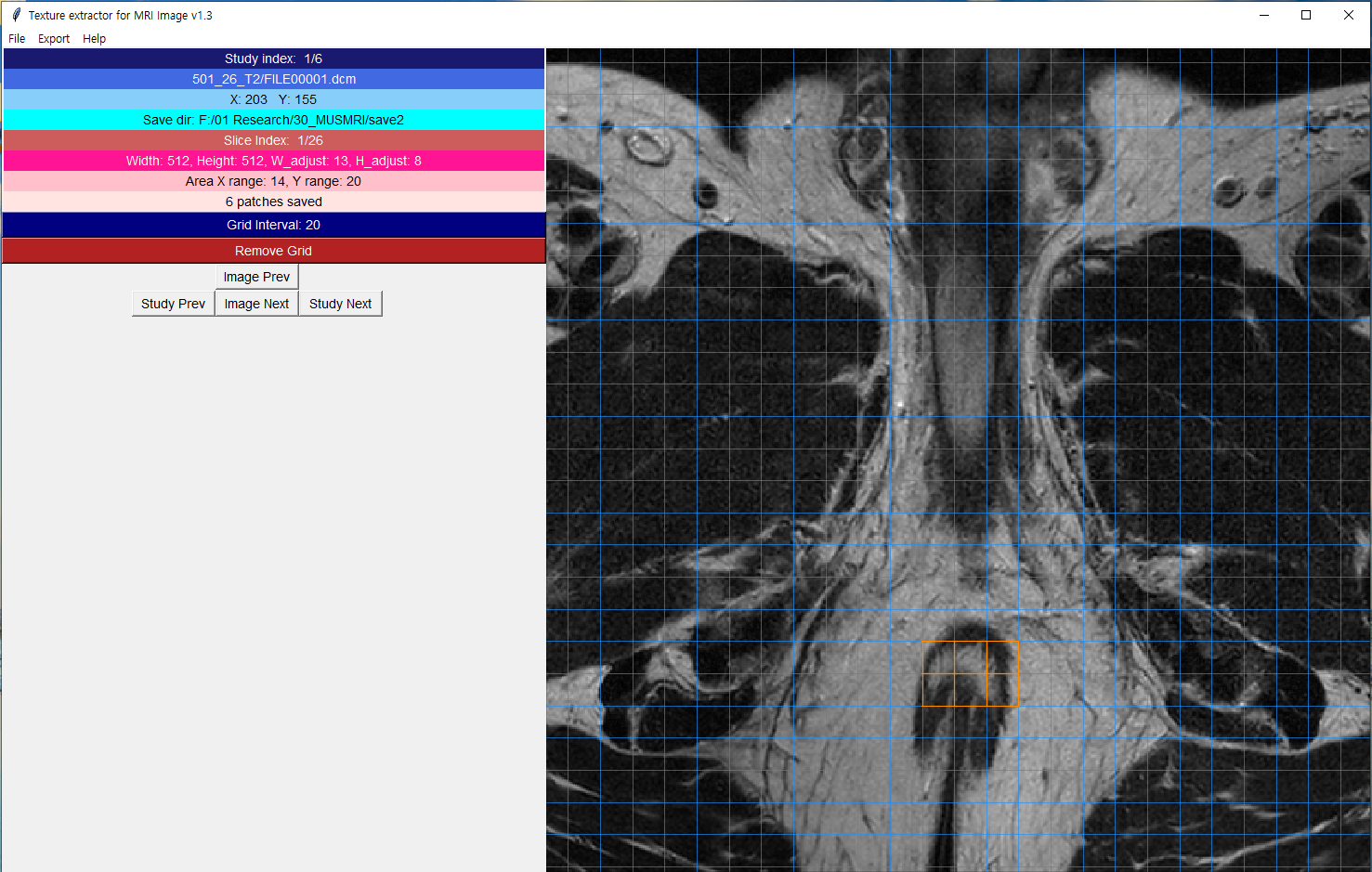 GitHub - djchoi1742/Patch_extractor: Software to extract and save ...