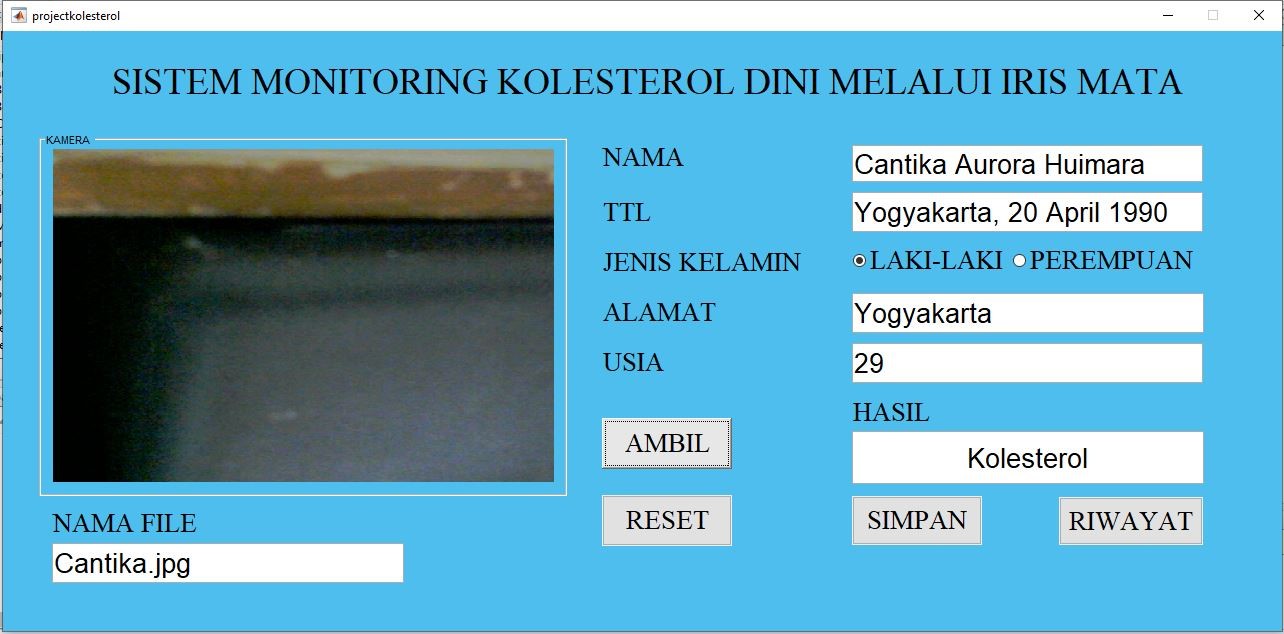 GitHub - ASNProject/Project-Deteksi-Kolesterol-MATLAB