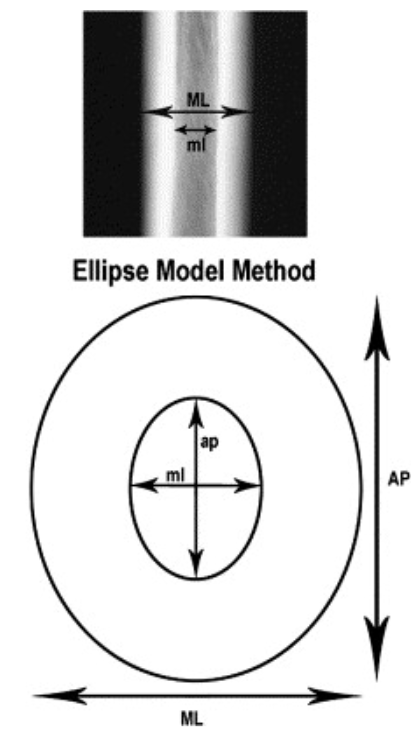 GitHub - ktuosto/Bone-Cross-Sectional-Geometry: Bone cross-sectional geometry (CSG) formulas in R