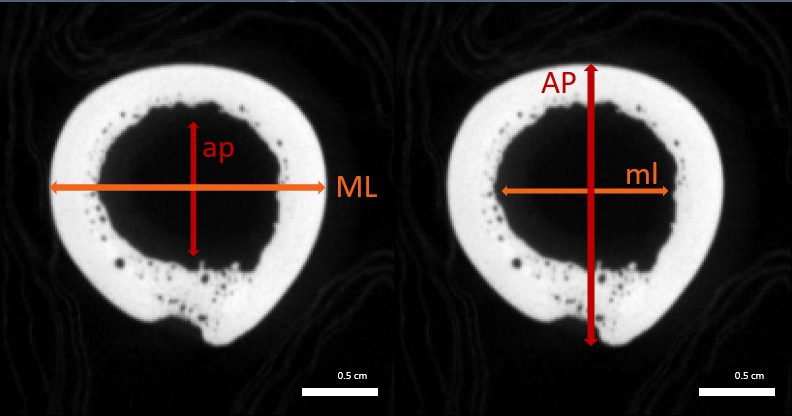 GitHub - ktuosto/Bone-Cross-Sectional-Geometry: Bone cross-sectional geometry (CSG) formulas in R