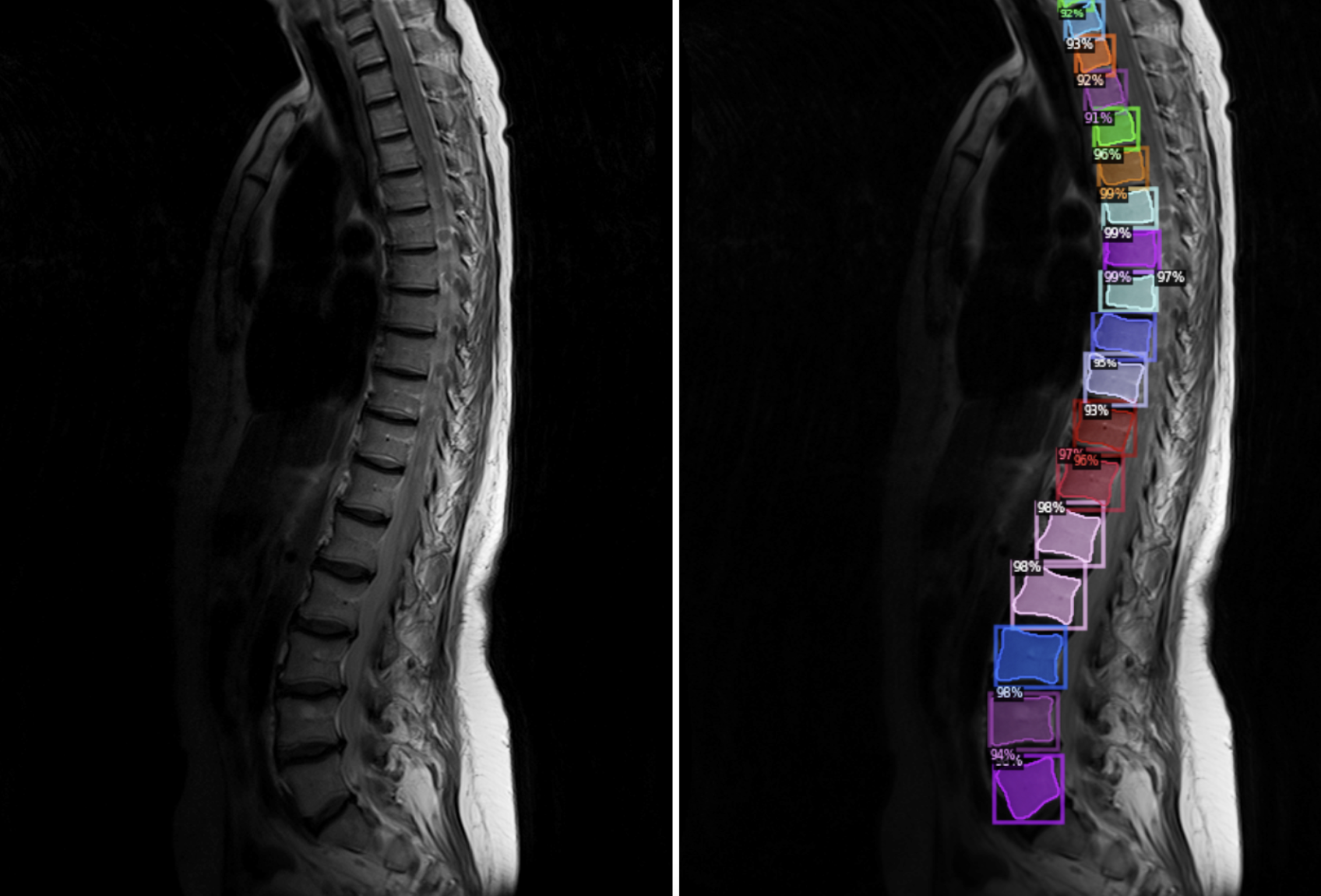 3D Data · Issue #541 · facebookresearch/detectron2 · GitHub