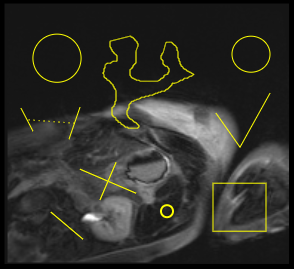 [Feature Request] TextBoxVisibility · Issue #751 · cornerstonejs/cornerstone3D · GitHub