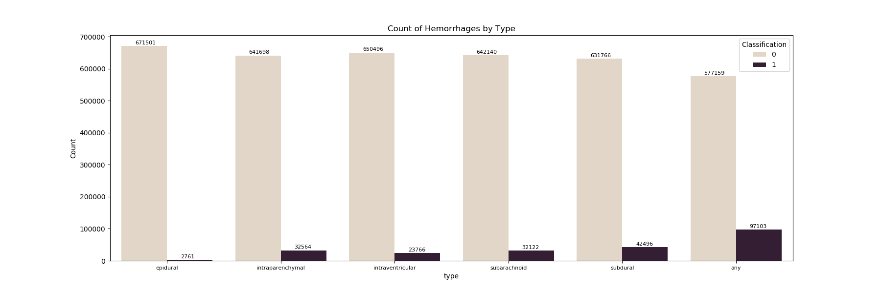 GitHub - KhoaHDLe/Hemorrhage-Detection: Identify acute intracranial hemorrhage and its sub-types