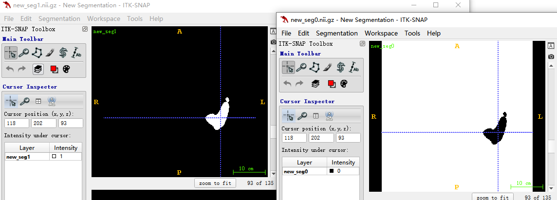 Spleen_segmentation_3d.ipynb was executed and the predicted label and background pixel values ...