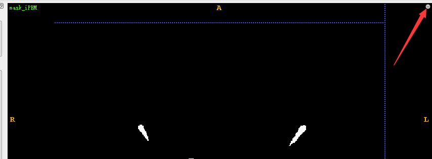 Spleen_segmentation_3d.ipynb was executed and the predicted label and background pixel values ...