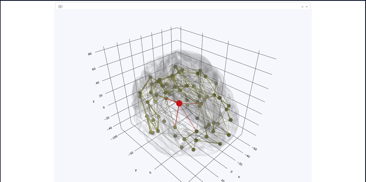 GitHub - con11235/BrainBrowser: 소프트웨어융합캡스톤디자인 - 박승혜