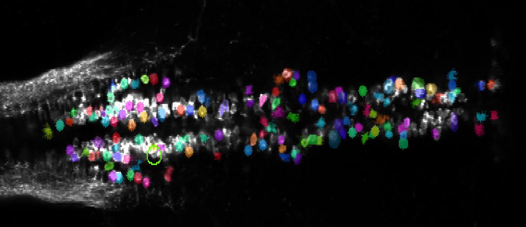 ROIs manually labelled not plotting when removing overlapping pixels · Issue #315 · MouseLand ...