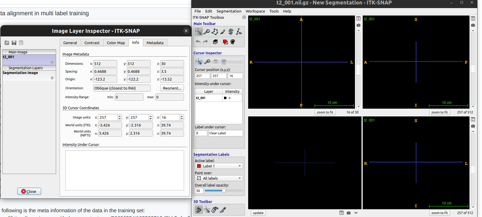 Data alignment in multi label training · Issue #1137 · MIC-DKFZ/nnUNet · GitHub